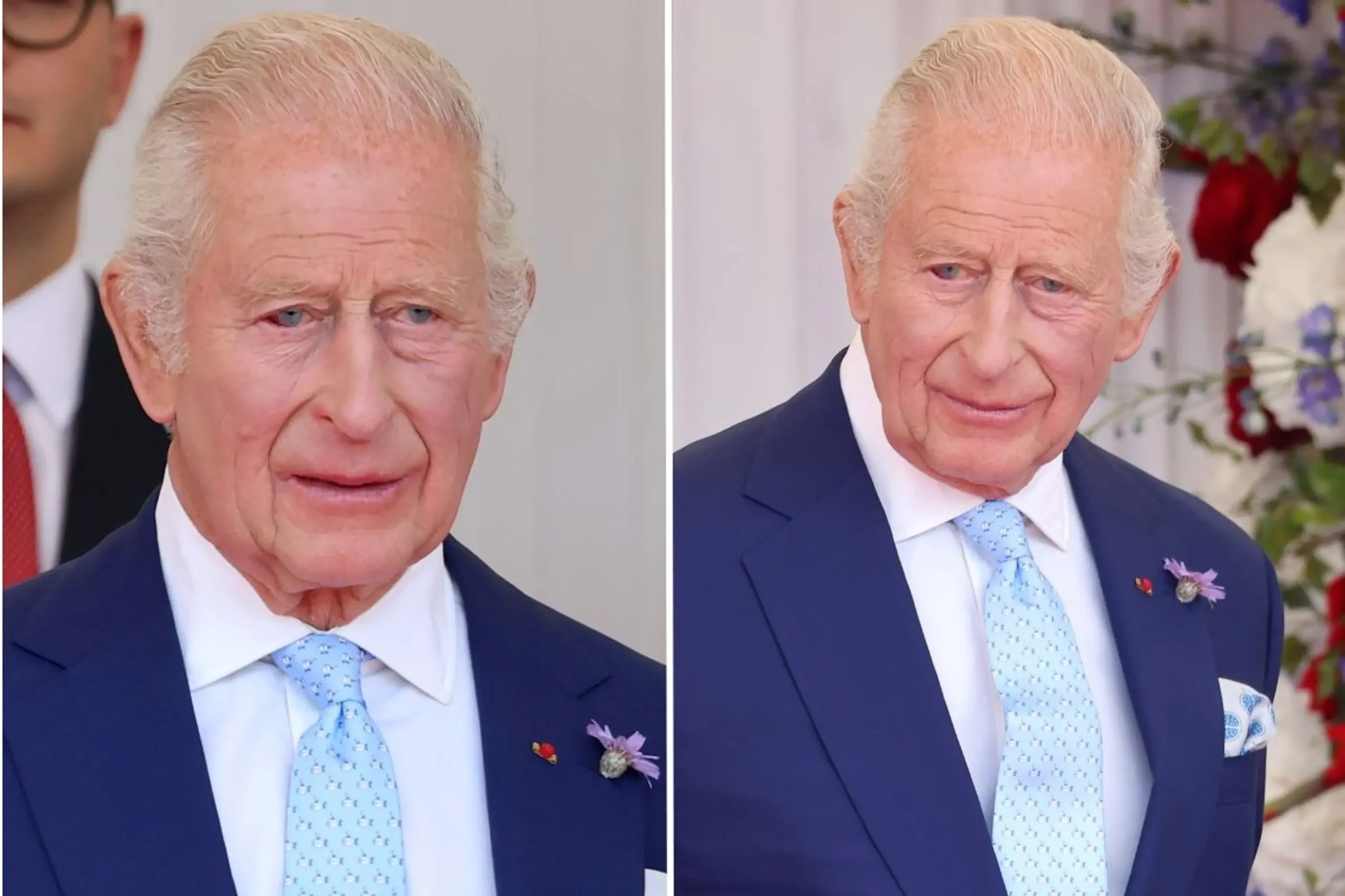 Breaking News: Buckingham Palace issues update as King Charles suffers burst blood vessel in ...